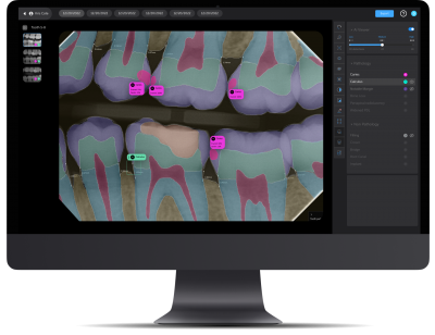 AI X-Ray Analysis Fairfax, VA | Improved Detection | Dentcare Now