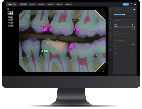 AI X-Ray Analysis Fairfax, VA | Improved Detection | Dentcare Now