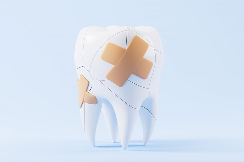 Emergency Broken Tooth Treatment in Fairfax, VA | Dentcare Now
